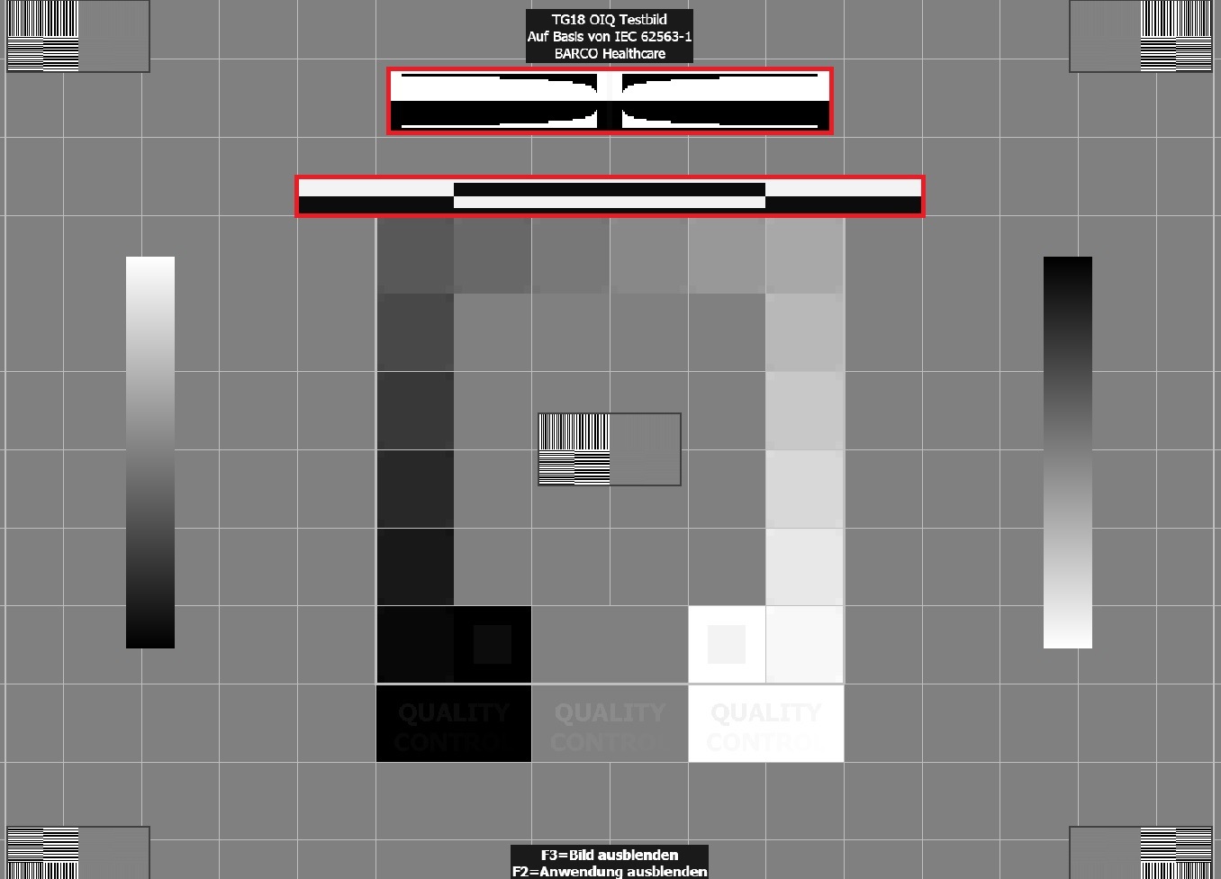 How to evaluate the TG18-OIQ (Quality Control) test pattern during a ...